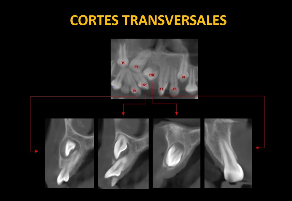 Caso N°683: Piezas Supernumerarias – CDI Perú